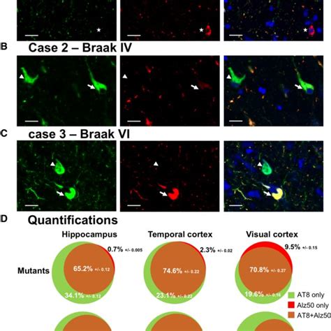 Differential Of Spreading Of Tau Pathology Between Tau Species A And Download Scientific