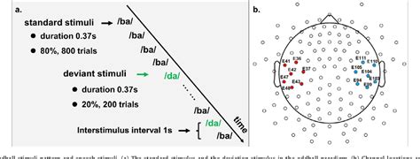 Figure 1 From Features Of Beta Gamma Phase Amplitude Coupling In