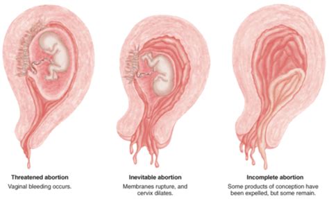 Test 2 230 Flashcards Quizlet
