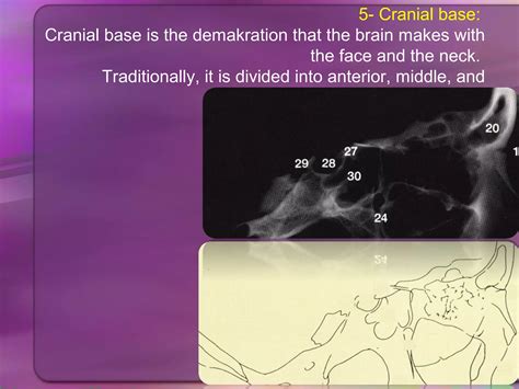 Lateral Cephalometric Analysis In Orthodontic Ppt