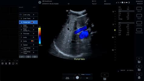 Ge Ultrasound Feature Scan Assistant Customizes And Standardizes Ge Ultrasound Feature Scan Assistant Customizes And Standardizes