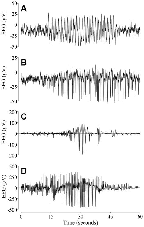 examples of raw eeg data taken from individual fetuses with