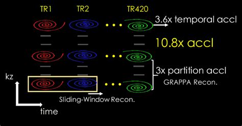 3d Mr Fingerprinting C2p
