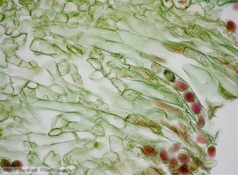 Morchella Under Microscope