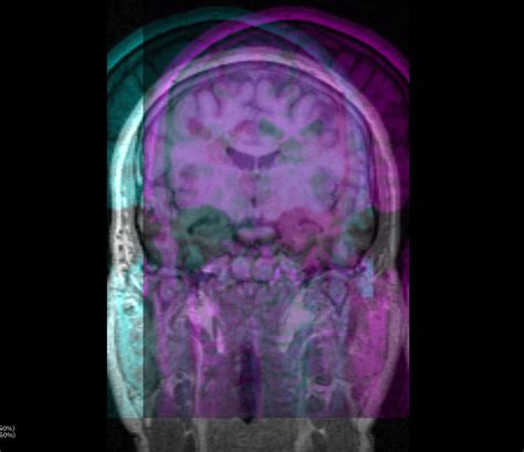 Trame Slicer Bringing The Power Of 3d Slicer To The Web