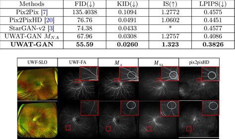Uwat Gan Fundus Fluorescein Angiography Synthesis Via Ultra Wide Angle Transformation Multi