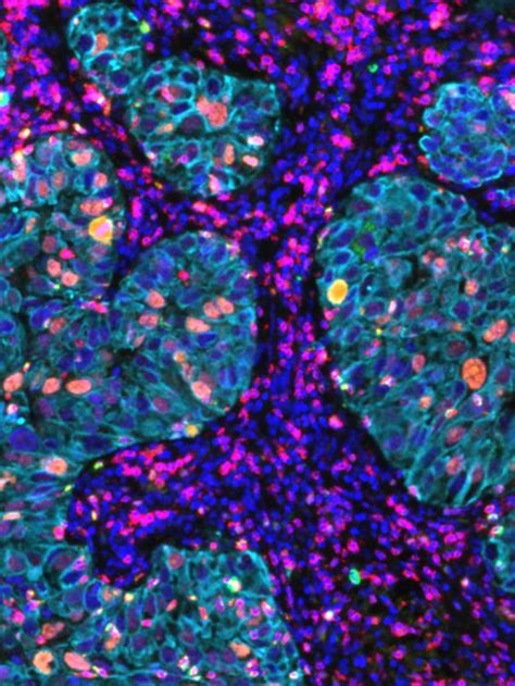 vizgen and ultivue merge to enable deeper insights into disease