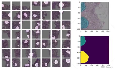 Ai实战营：语义分割与mmsegmentation Csdn博客