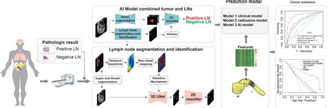 Artificial Intelligence To Predict Lymph Node Metastasis At Ct In Pancreatic Ductal