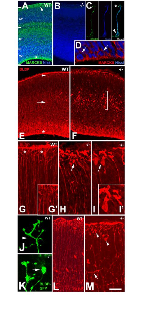 Disruption In Radial Glial Scaffold In Marcks Cerebral Cortex A D Download Scientific