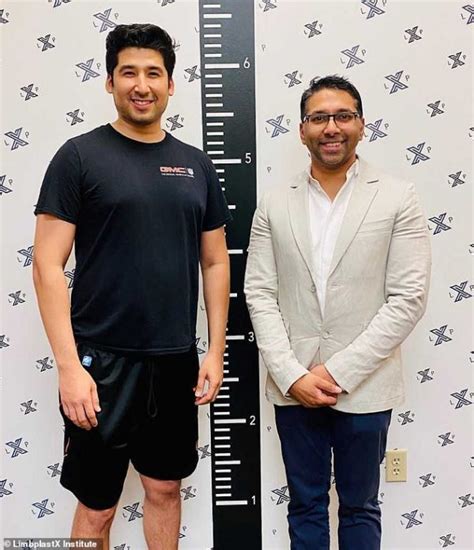 511 Man Undergoes Surgery To Lengthen His Limbs And Become 61