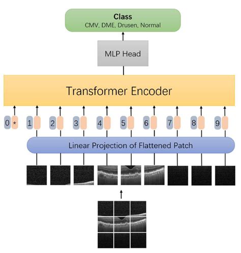 Diagnosis Of Retinal Diseases Using The Vision Transformer Model Based On Optical Coherence