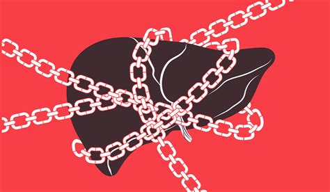 Liver Failure What Is Causes Diagnosis And Treatment