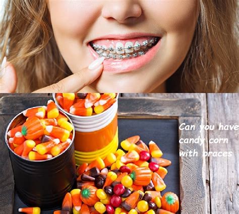 Can You Have Candy Corn With Braces