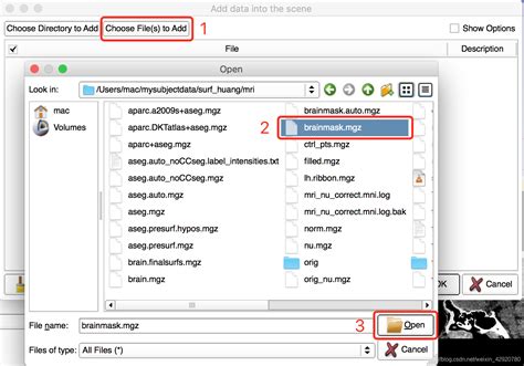 实现seeg电极触电的自动分割 slicer seeg csdn博客