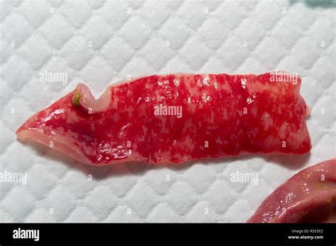 Portion Of A Cat Intestine With Hemorrhagic Enteritis Caused By