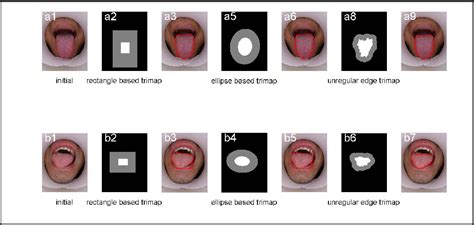 Figure 1 From Automatic Tongue Image Segmentation Based On Histogram Projection And Matting