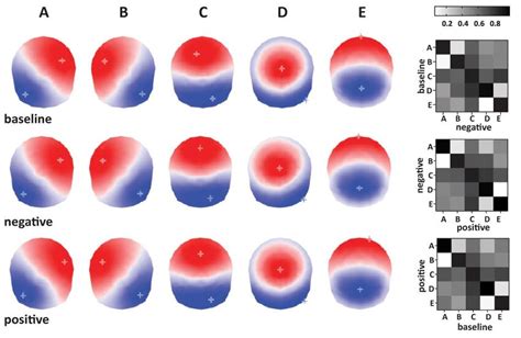 Left Microstate Topographies Identified For Each Condition Top To