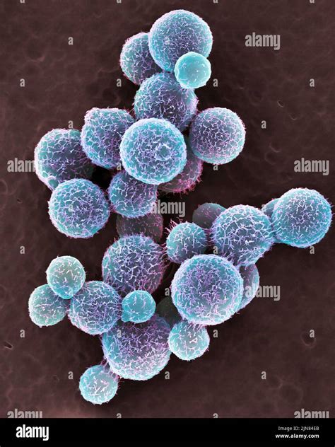 Cryptococcus Neoformans Yeast SEM Stock Photo Alamy