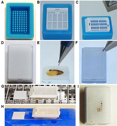 Recommendations For Tissue Microarray Construction And Quality Assurance Pmc