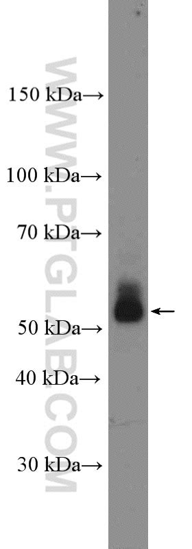 Cd1d Antibody 17336 1 Ap Proteintech