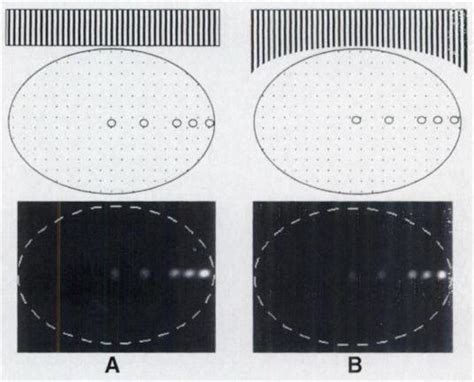 Spatial Resolution Assessed By Simulated Spect Data With Three Download Scientific Diagram