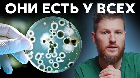 ОНИ ЕСТЬ У ВСЕХ - Кандиды. Как избавиться от молочницы? - YouTube