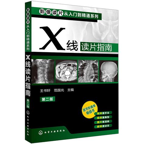 X线读片指南第2版 X线读片指南医学卫生影像医学化学工业出版社影像读片从入门到精通系列病种齐全病例典型图片清晰解释详尽 虎窝淘