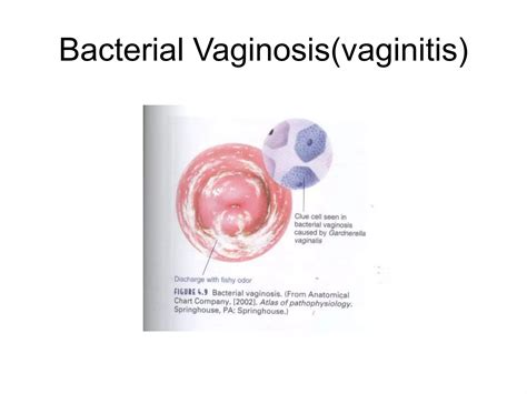 Fectious Disease Of Genitalia And Sexual Transmitted Infections