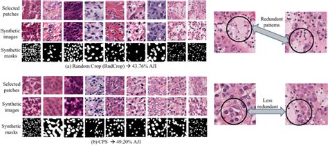 Visualized Comparison Between The Proposed Consistency Based Patch Download Scientific Diagram