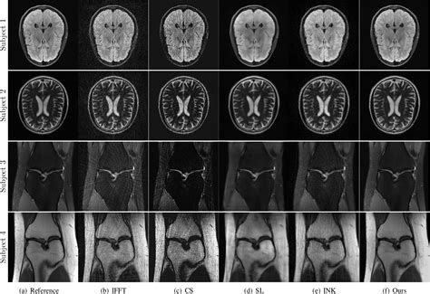 Figure 2 From Nerf Solves Undersampled Mri Reconstruction Semantic Scholar