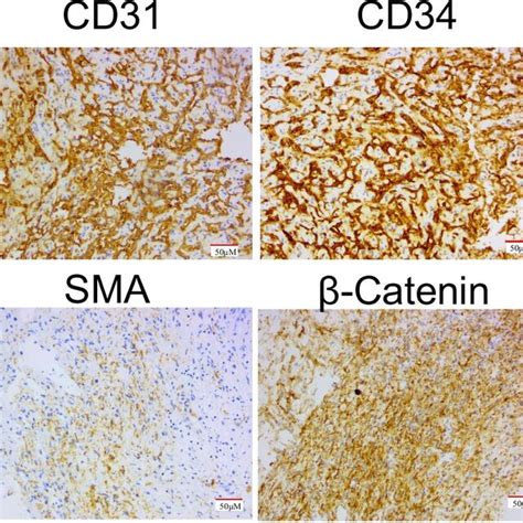 He Staining And Ihc Staining Of Tumor Tissue A Tumor Cells Were Download Scientific Diagram