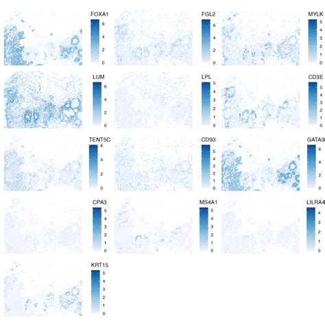 Xenium Breast Cancer Dataset • Voyager