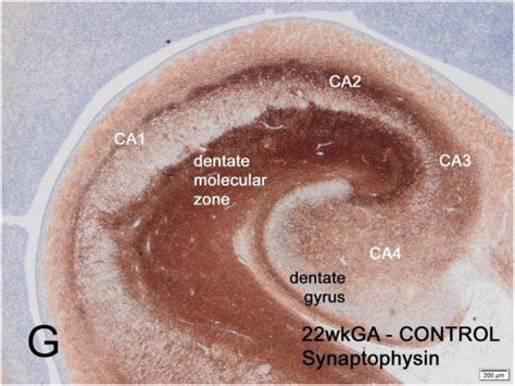 Sequences Of Synaptogenesis In The Human Fetal And Neonatal Brain By Synaptophysin