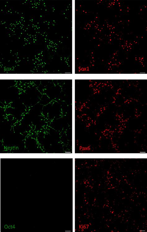 Derivation Of Adult Human Fibroblasts And Their Direct Conversion Into Expandable Neural