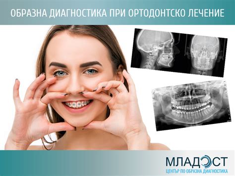 Образна диагностика при ортодонтско лечение Център по образна диагностика МЛАДОСТ