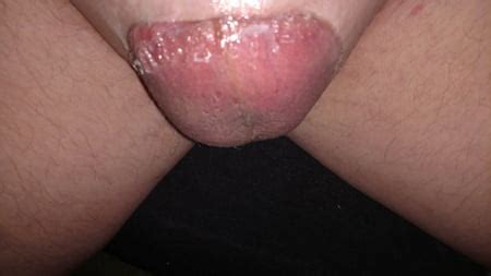 Super Glue Fun Pics Xhamster