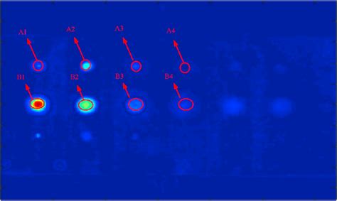 Enhanced Thermograms Using Structured Sparse Matrix Decomposition Download Scientific Diagram
