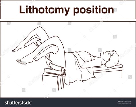 Woman Lithotomy Position Stock Vector Royalty Free 756056896 Shutterstock