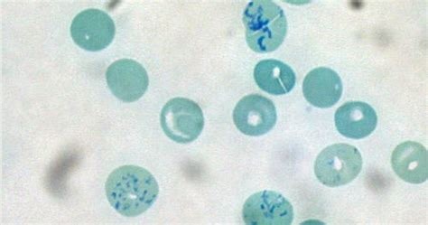 Medical Laboratory And Biomedical Science Reticulocyte Count