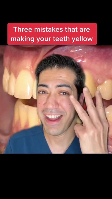 3 Mistakes That Are Making Your Teeth Yellow Yellowteeth