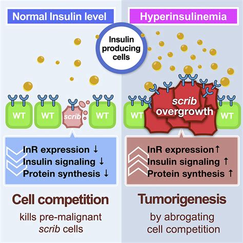 Hyperinsulinemia Drives Epithelial Tumorigenesis By Abrogating Cell
