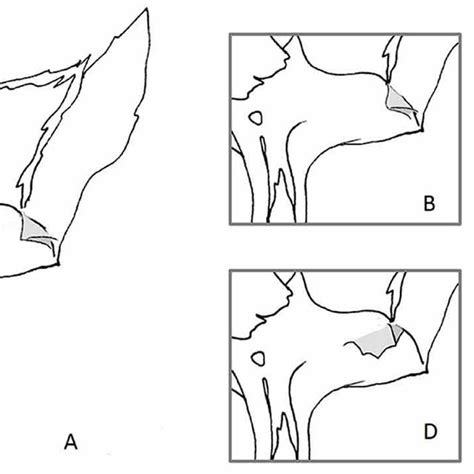 Relationship With Infratemporal Crest A A Complete Relation Between Download Scientific