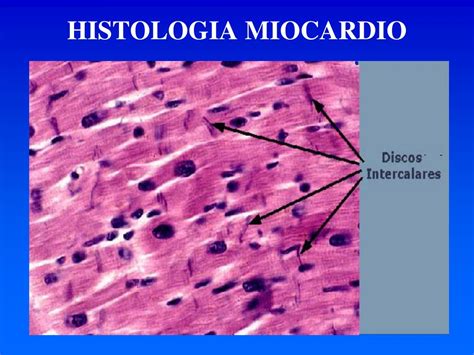 Ppt Musculo Cardiaco Powerpoint Presentation Free Download Id1120035