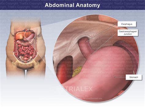 Abdominal Anatomy Gastroesophageal Junction Trialquest Inc