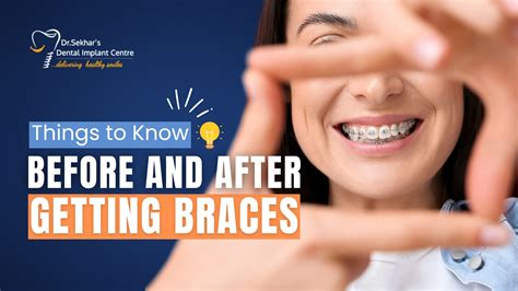 Things To Know Before And After Getting Braces