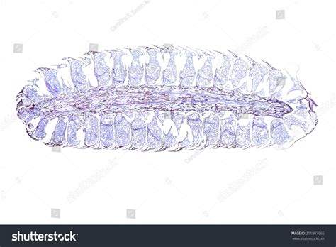 Pinus Staminate Male Pine Cone Microscope Slide Longitudinal Section