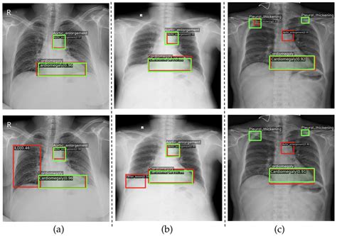 Heart Structure Segmentation On Mmwhs Ct The Figures Show That