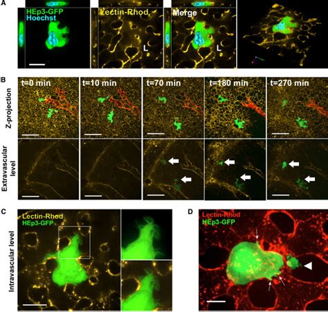 Invadopodia Are Required For Cancer Cell Extravasation And Are A