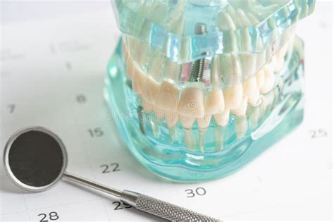 Dental Implant Artificial Tooth Roots Into Jaw Root Canal Of Dental Treatment Gum Disease